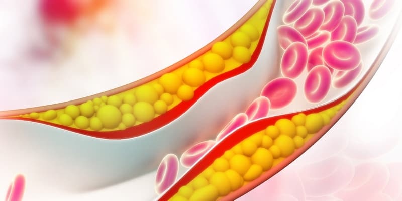 Apa itu Kolestrol: 2019