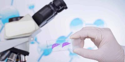 Biopsi: Jenis, Prosedur, dan Hasilnya • Deherba.com