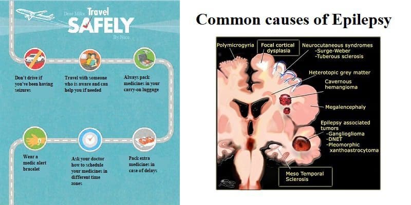 Kejang: Penyakit Ayan atau Penyakit Epilepsi • Deherba.com